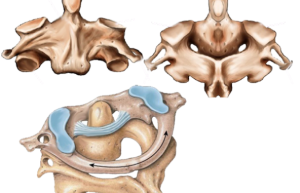 Pathologie du rachis cervical - Institut Rennais de Chirurgie ...